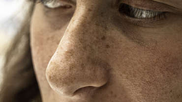 Dermatology & Laser Skin Treatments | Mclean & Woodbridge, VA | Skin ...